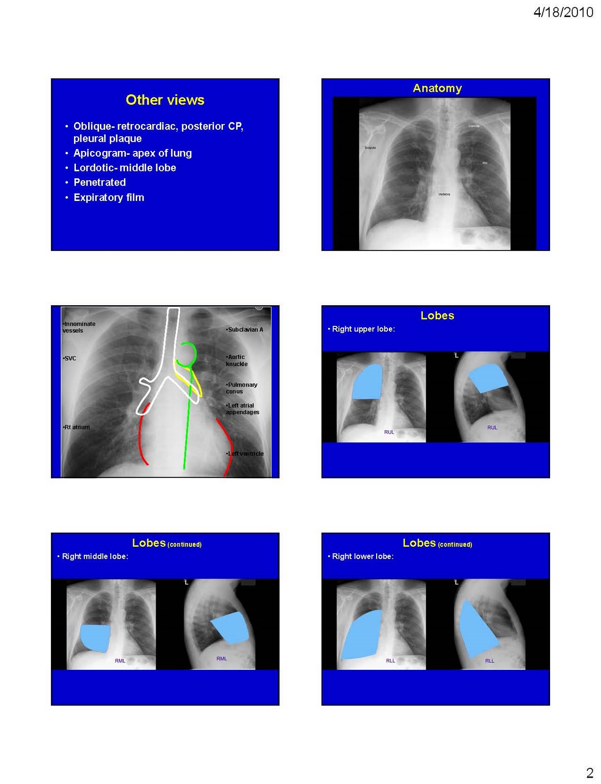 Respiratory Critical Care and Sleep Medicine: CHEST X-RAY ...